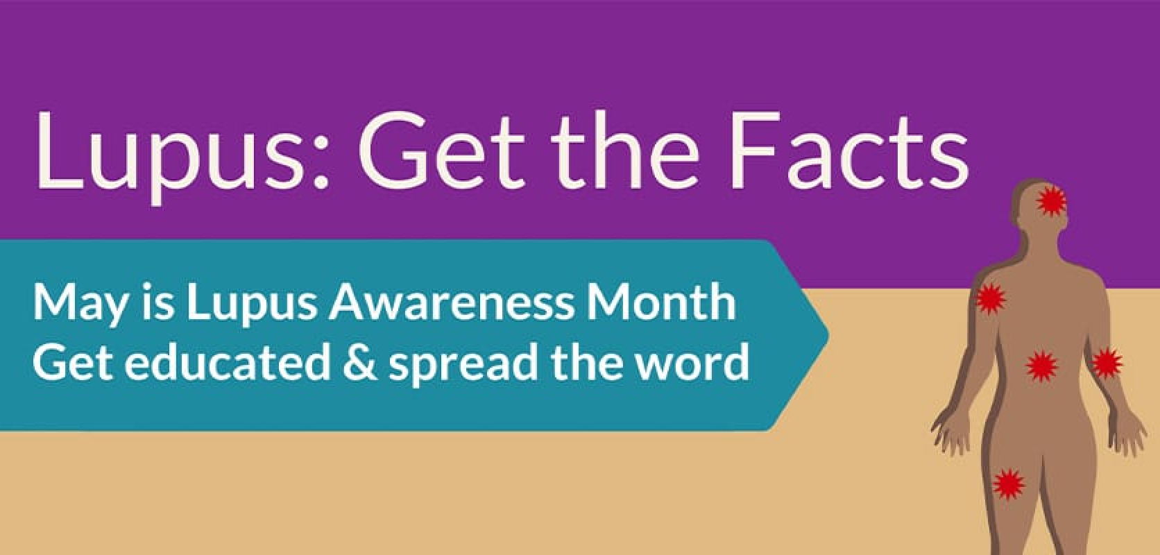 Infusion Therapy for Lupus | Raise Lupus Awareness I PHO