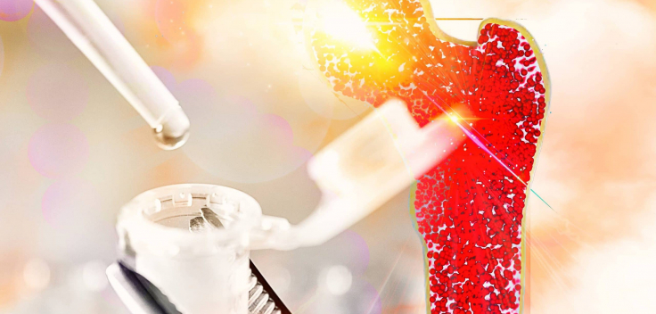 Find Out About Becoming a Bone Marrow Donor