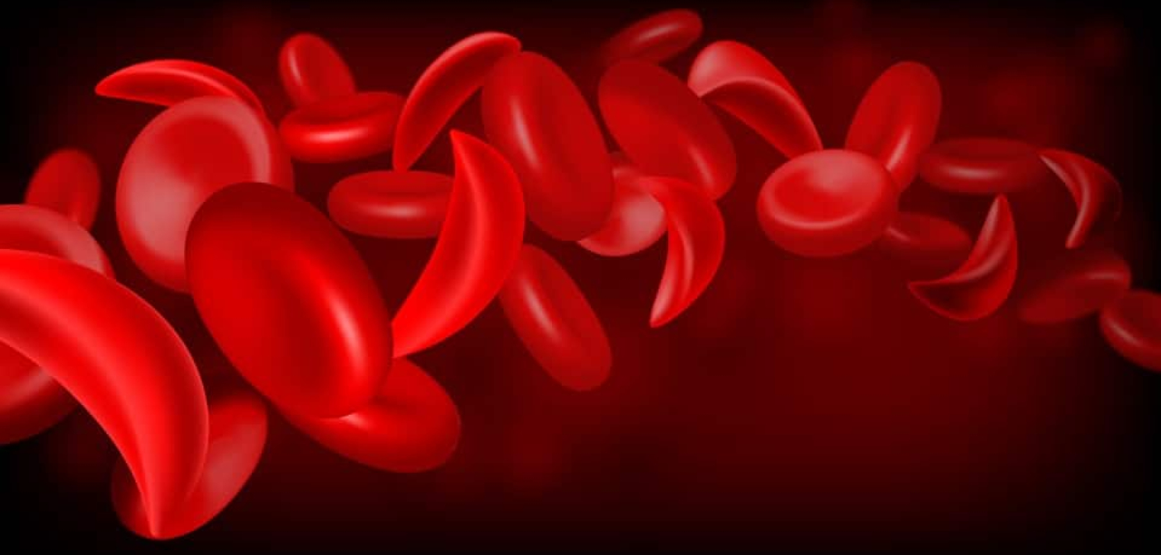 Sickle Cell Anemia Treatments & Tips for a Healthy Life