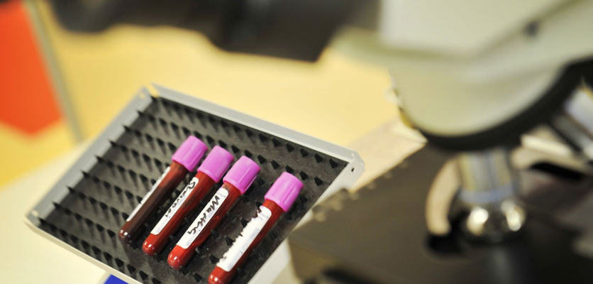 Seeing Red: Bleeding Disorders Explained - Local Hematology Services